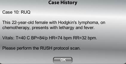 How SonoSim LiveScan® Brings Ultrasound Simulation to Life
