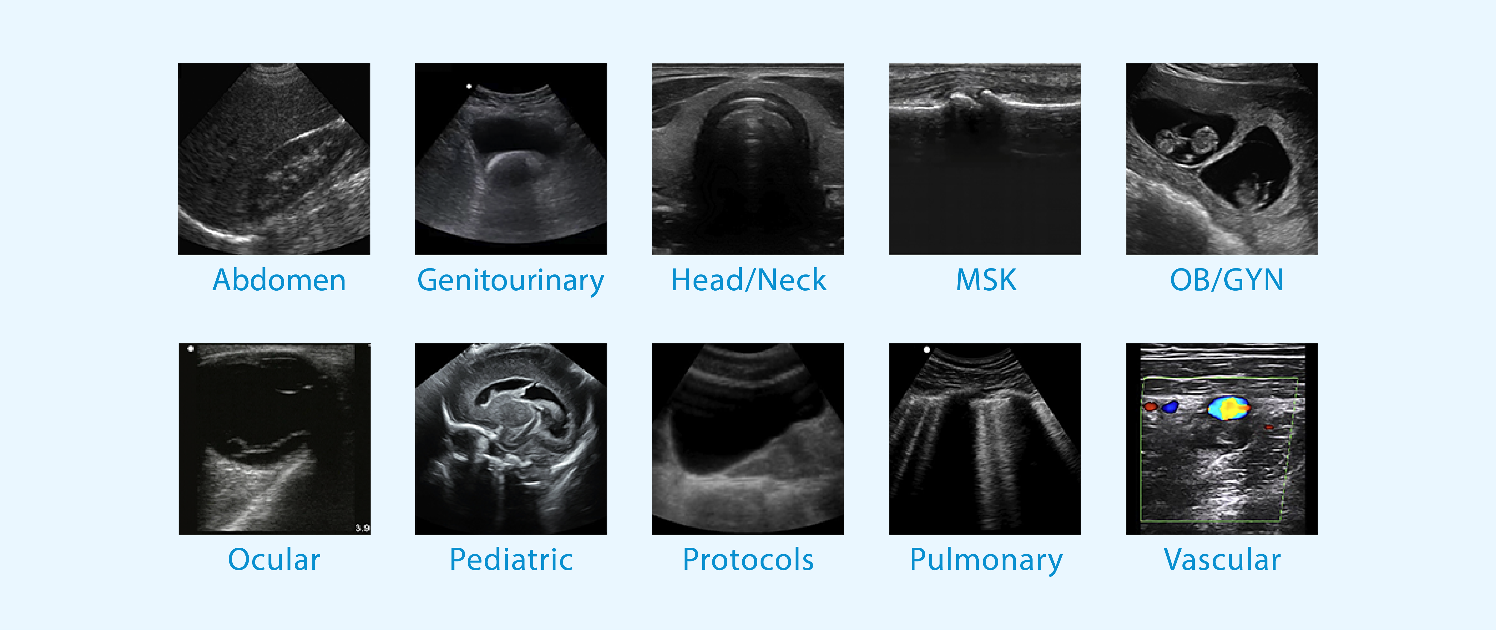 Ultrasound Study Resources & Tools to Enhance Sonography Skills