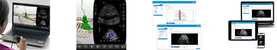 Vascular Ultrasound Training