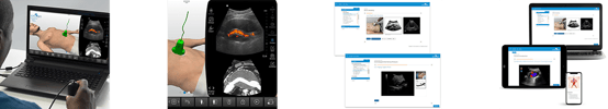 Vascular Ultrasound Training