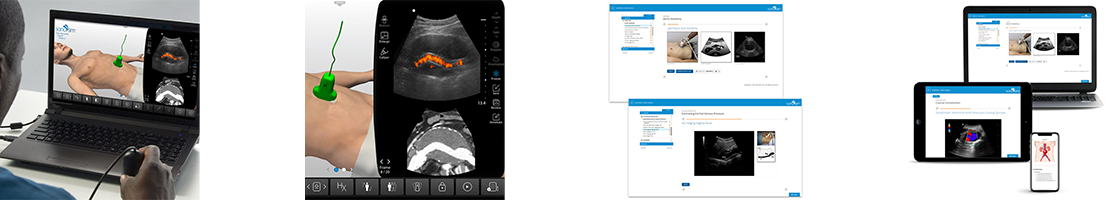 Vascular Ultrasound Training
