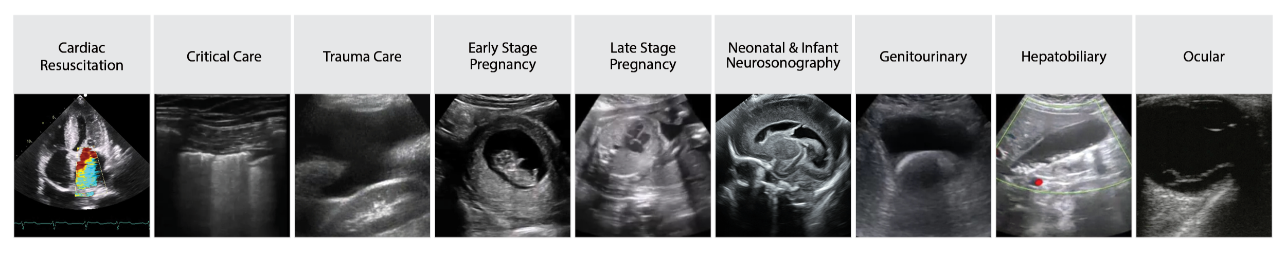 Ultrasound Simulation Training - Simulation Centers - SonoSim