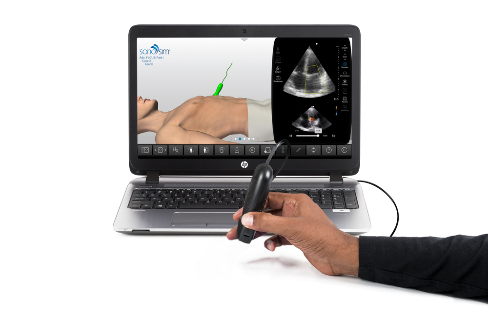 SonoSim Contact