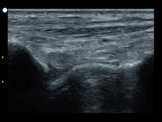 MSK Ultrasound Training