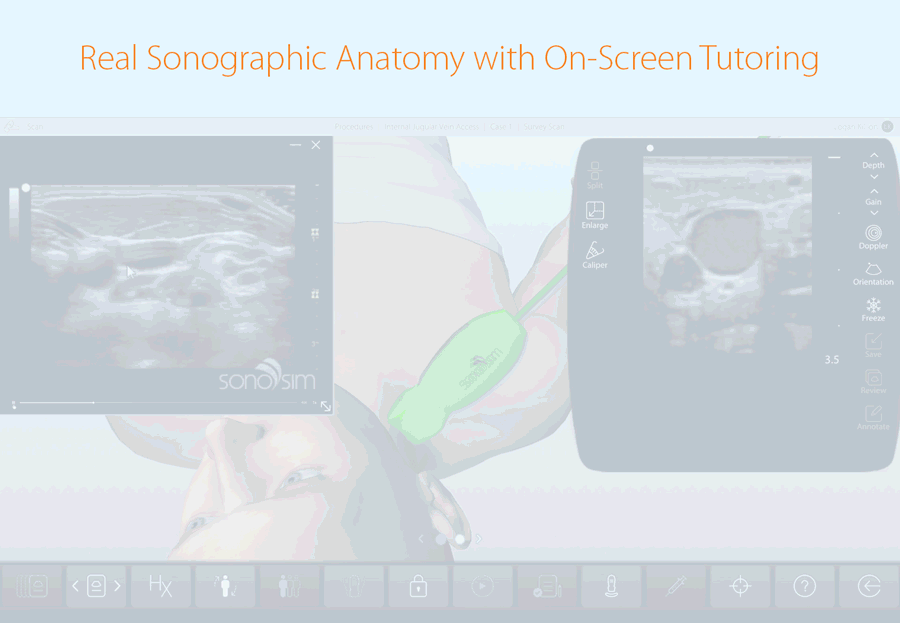 Knee Joint Injection & Aspiration Procedure | SonoSim