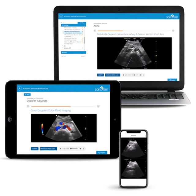 Aorta & Inferior Vena Cava (IVC) Ultrasound Training | SonoSim
