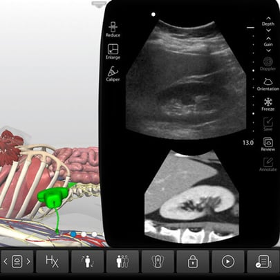 Pulmonary Ultrasound Training
