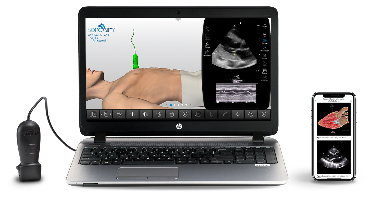 SonoSim Product Documentation