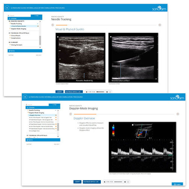 Internal Jugular Vein Cannulation Ultrasound-Guided Procedure Training ...